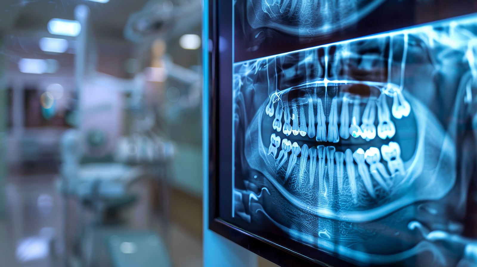 Mascella e mandibola: quali sono le differenze? | GUM®