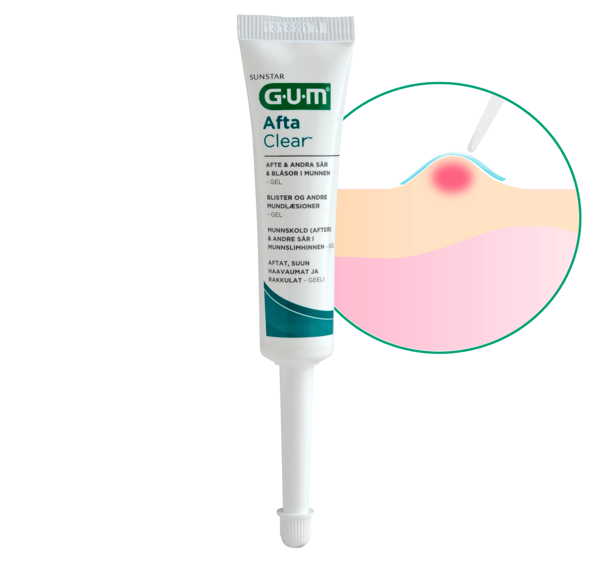 Afte – Orsaker, symtom och behandling | GUM®