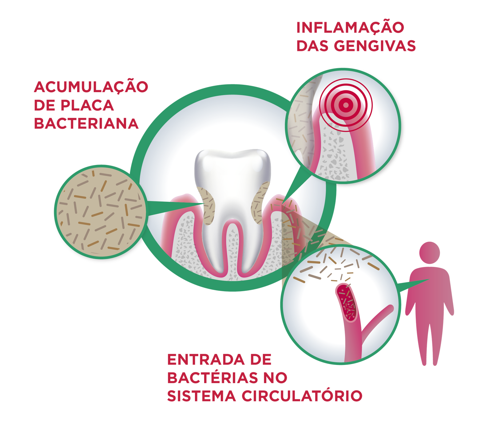 Gengivas Saudáveis, Vida Saudável | SUNSTAR GUM®