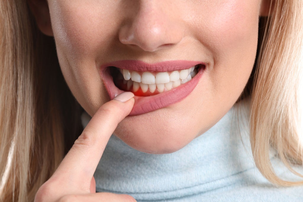 The Difference Between Sensitive and Sore Gums, Gingivitis, and Gum Disease