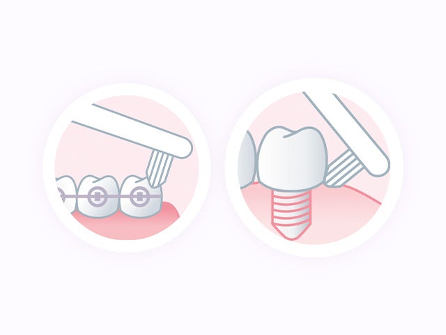 Brosse à dents GUM® Monotouffe, idéale implants et brackets