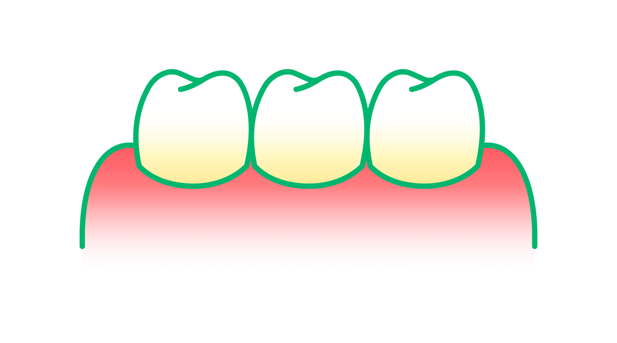 Gum Sensitivity & Inflamed Gums: Causes & Solutions