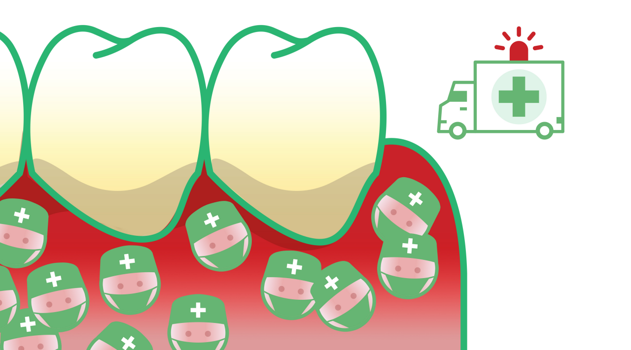 Gum Inflammation and Disease Explained