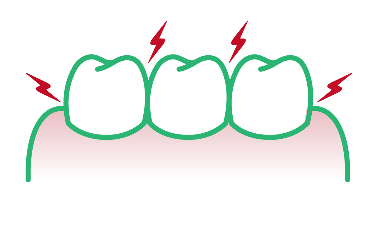 Tooth Sensitivity: Causes, How to Manage and Prevent It