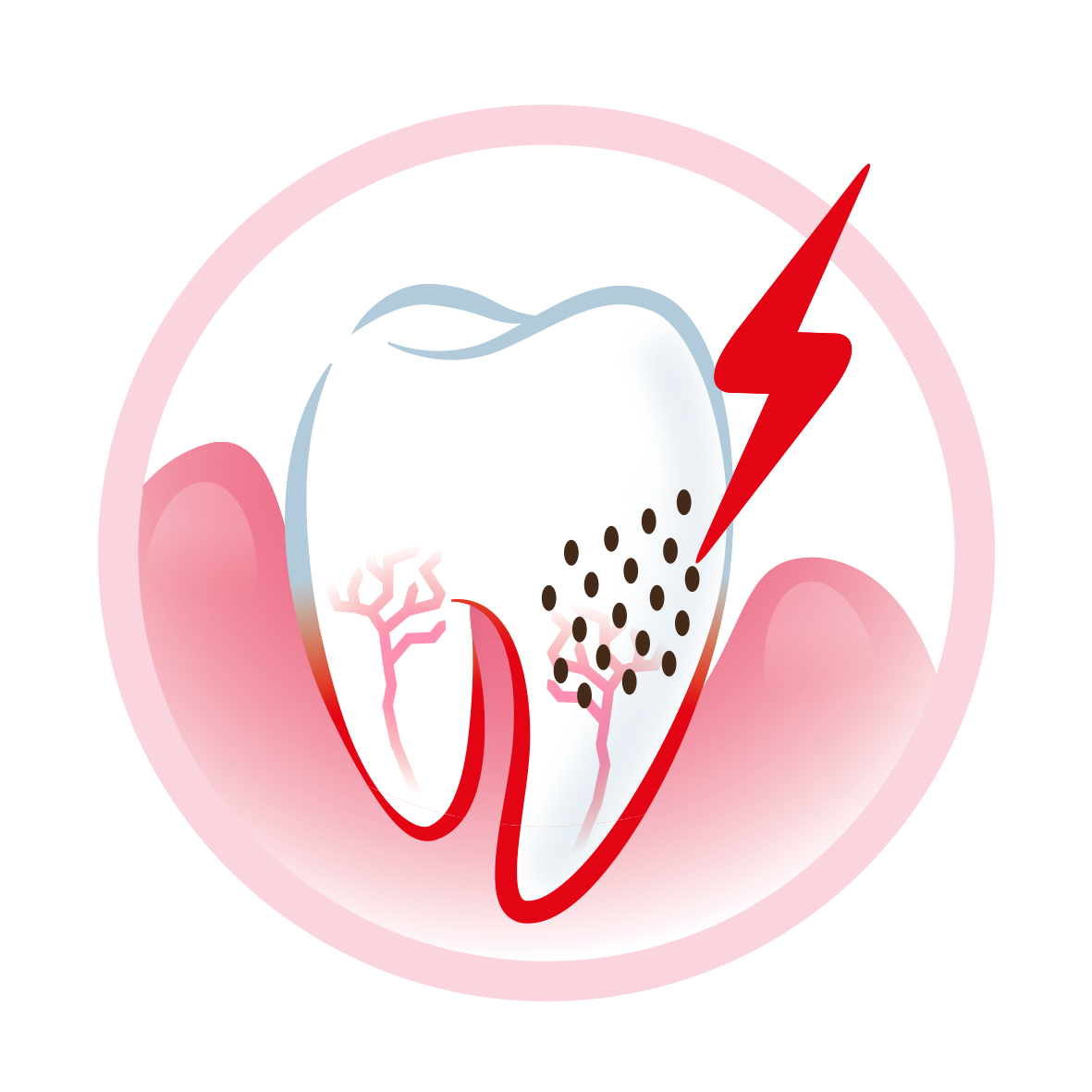 Tooth Sensitivity: Causes, How to Manage and Prevent It