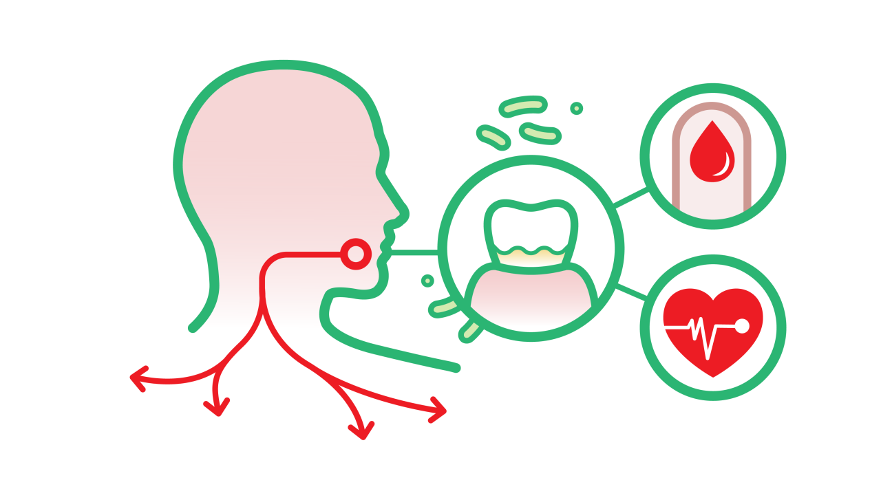 How Does Plaque Form & Why You Should Care About It?